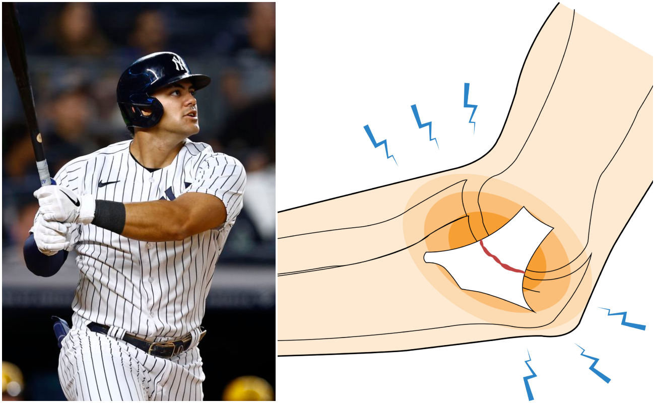 Jasson Dominguez's Injury: Yankees Brace For Worst-Case Outcome